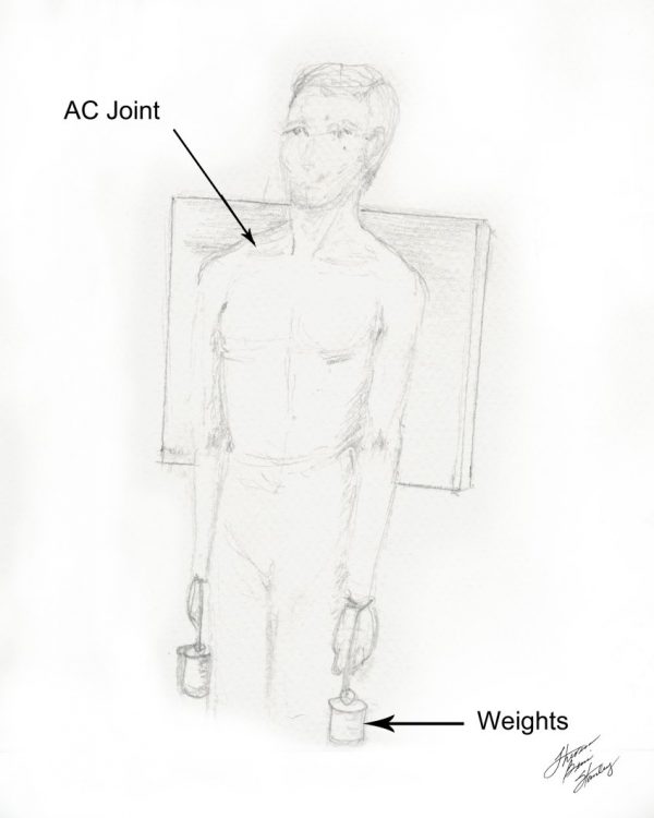 AC Joint Injuries.....Classification and Treatment Guidelines Copy ...